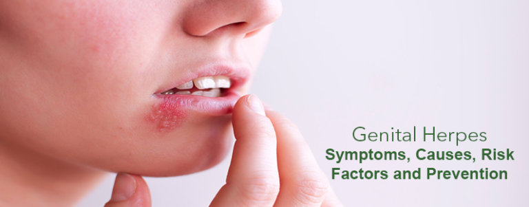 Genital Herpes- Symptoms, Causes, Risk Factors and Prevention