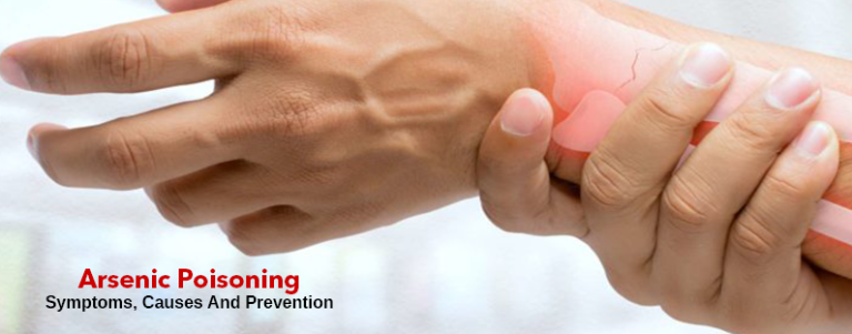 Arsenic Poisoning- Symptoms, Causes and Prevention
