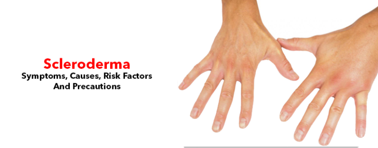 Scleroderma- Symptoms, Causes, Risk Factors and Precautions