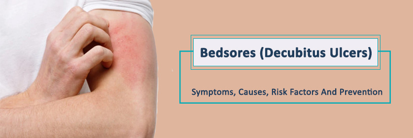 Bedsores (Decubitus Ulcers) - Symptoms, Causes, Risk Factors and ...
