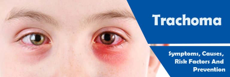Trachoma- Symptoms, Causes, Risk Factors and Prevention